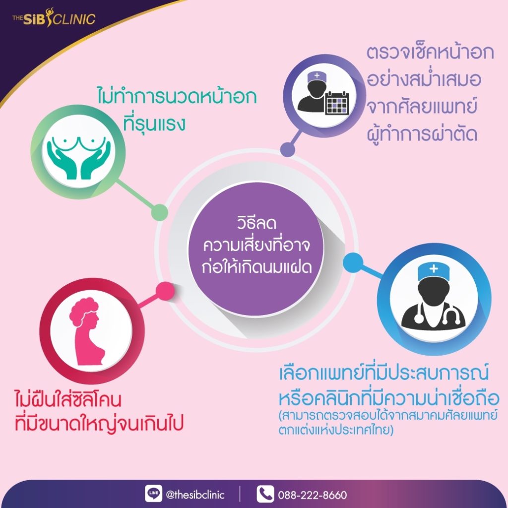ภาวะนมแฝดมี 2 สาเหตุหลัก เกิดได้ตั้งแต่เกิด และจากการผ่าตัด