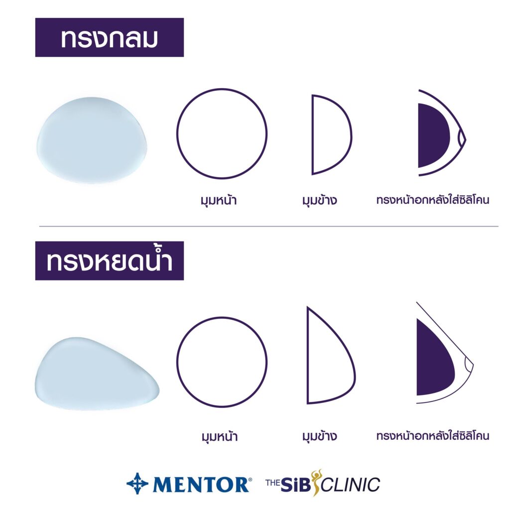 ซิลิโคน Mentor Memory Gel Xtra รุ่นใหม่ ต่างจากเดิมอย่างไร – The SIB ...